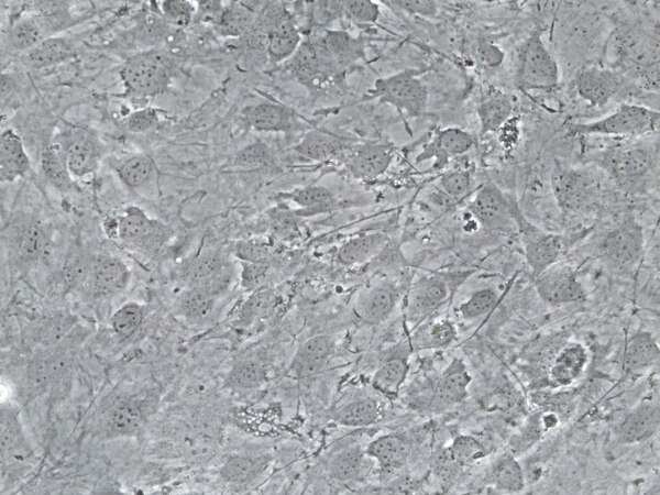 OP9-DL1 hDL-1-Expressing mOP9 Cell Line | SCC136